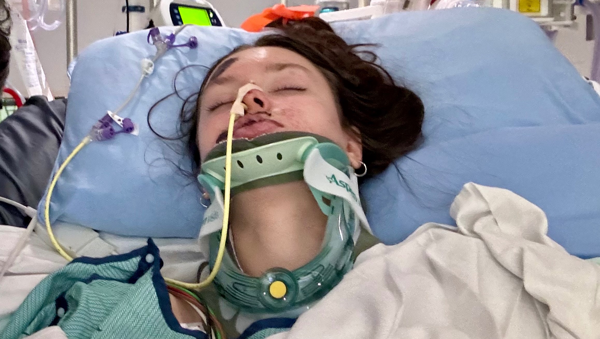 Fundraiser by Ian Cameron : Help Audrey Recover from her Traumatic Injuries