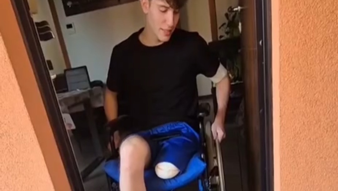 Fundraiser by Manuel Bortolotti : Una protesi per una vita migliore