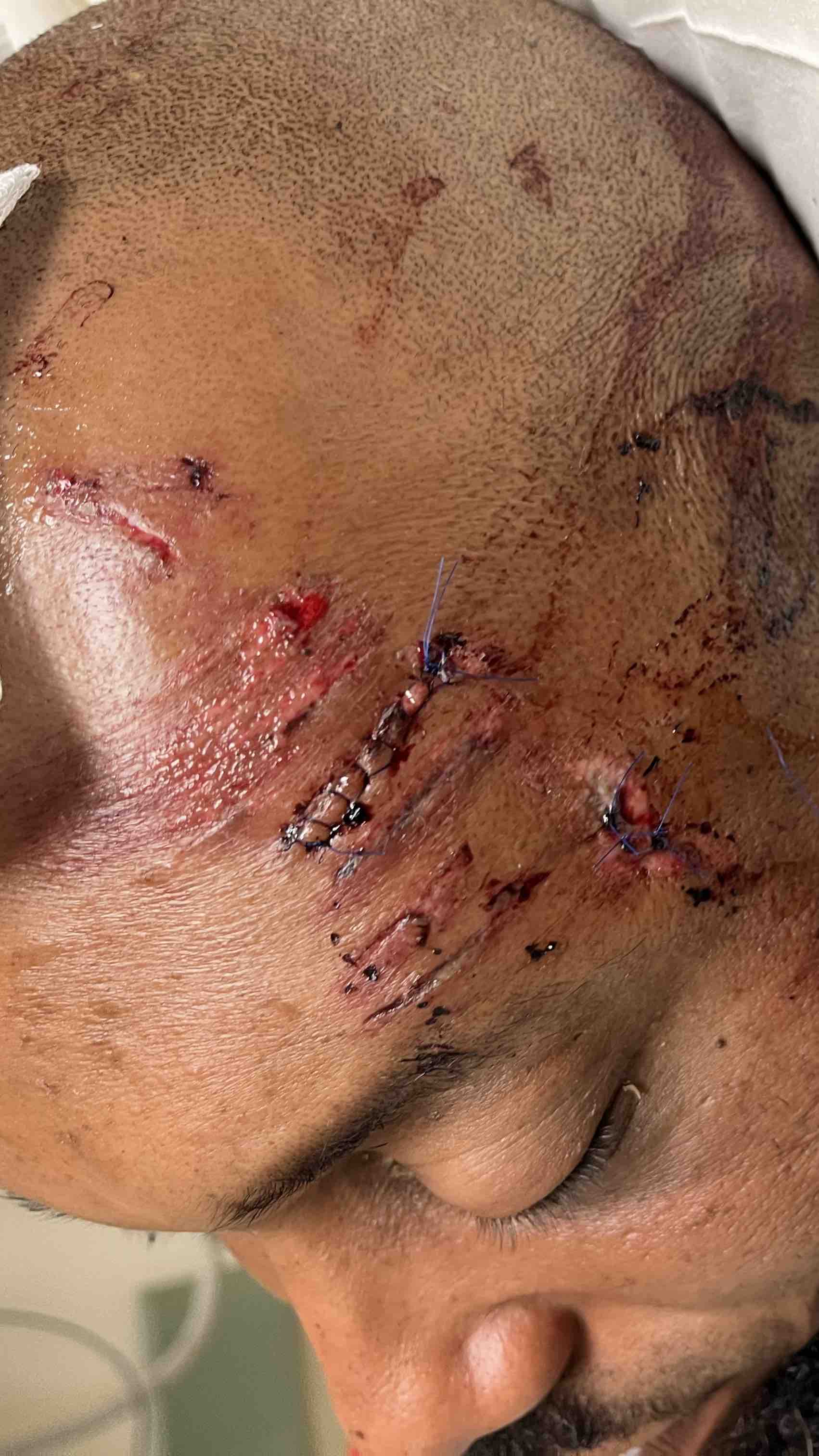 Fundraiser by Derrick Mahone : Support Derrick's Recovery After Motorcycle Accident