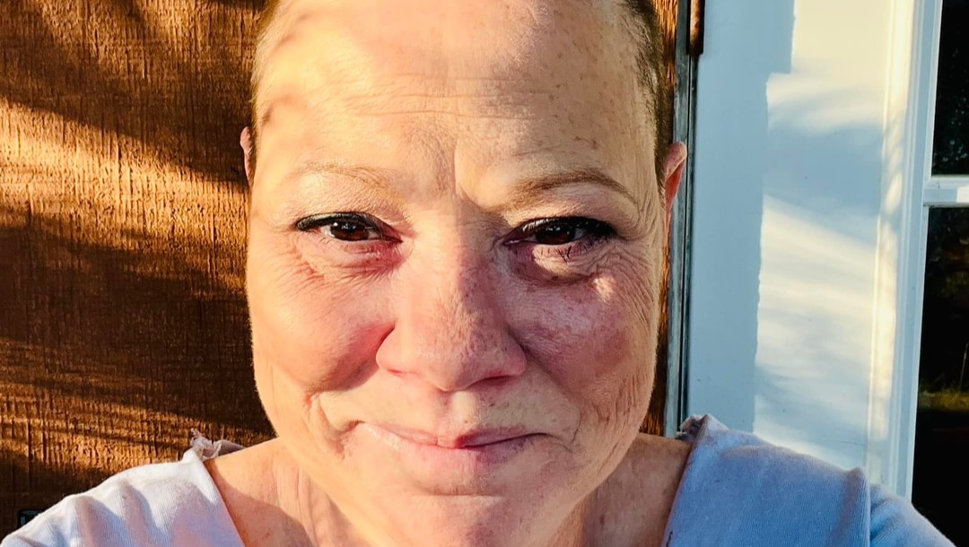 Fundraiser by Christina Keyes : Support Edy's Battle Against Her2 Cancer