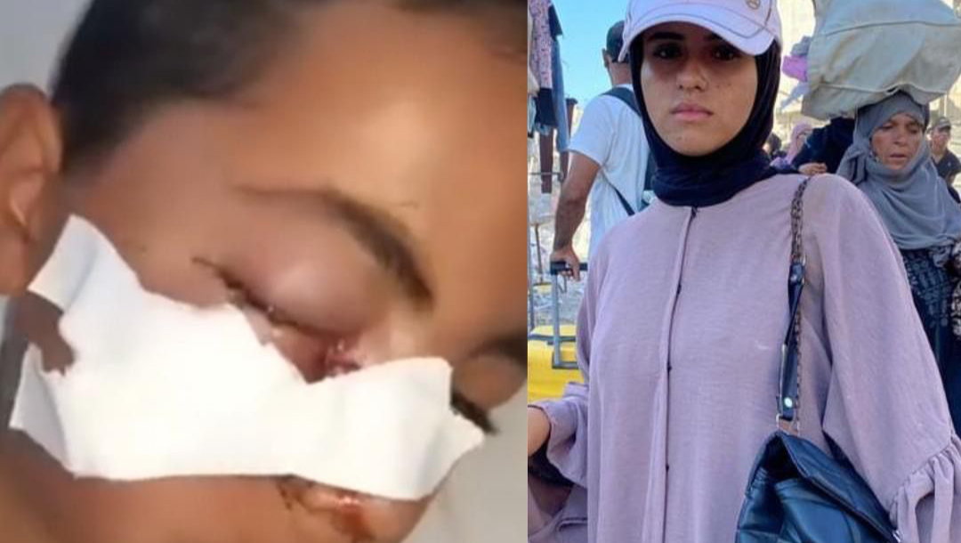 Fundraiser by Chloe Hart : Help Hanan save her brother's eye and family ...