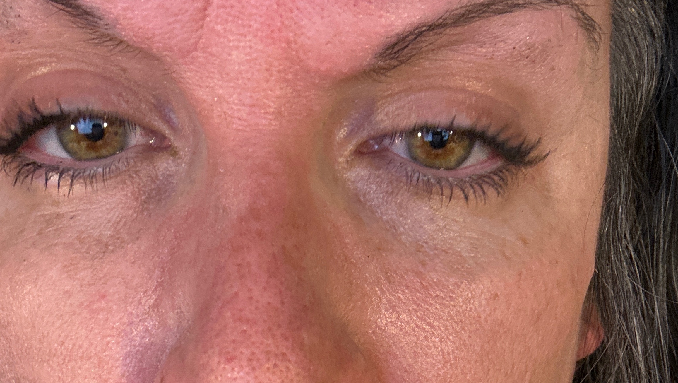 Fundraiser by Drake Mantheiy : Help Mom Battle Chiari Malformation Costs