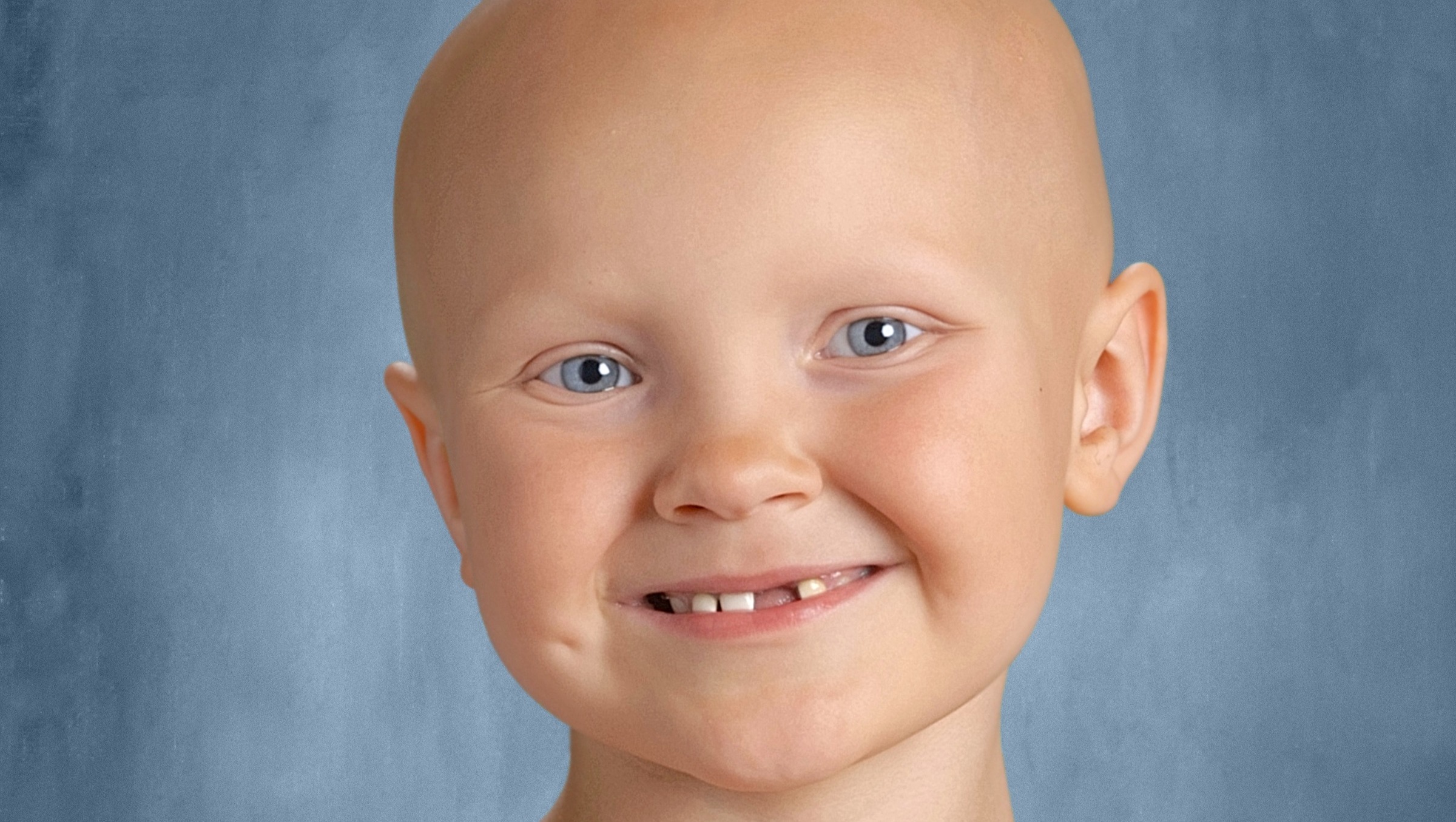 Fundraiser by Kimberly Voight : Help Harper Shine with a Custom Wig