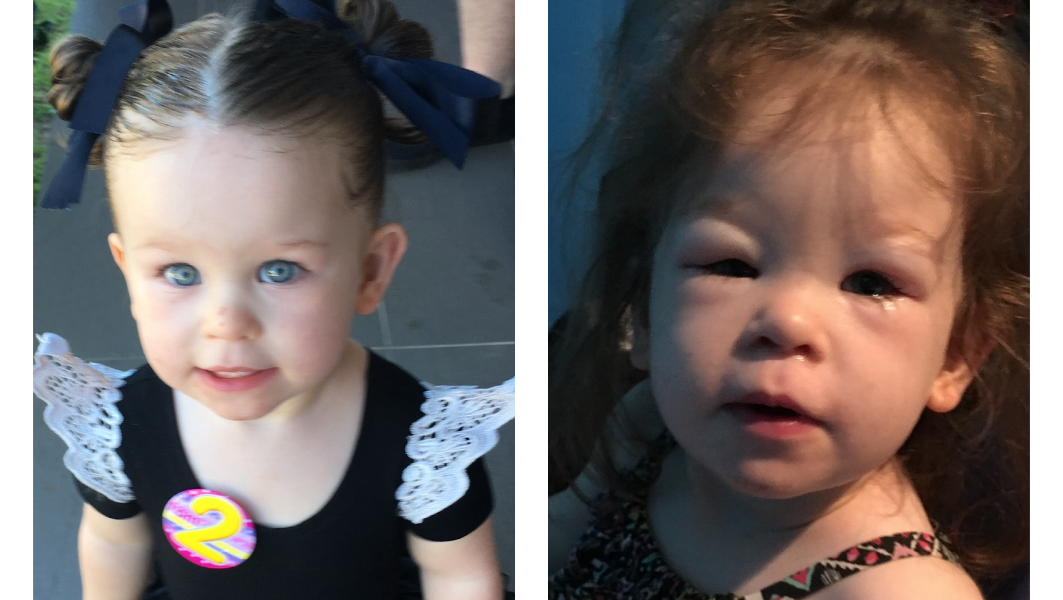 Fundraiser by Michelle Moylan : Tilly vs nephrotic syndrome