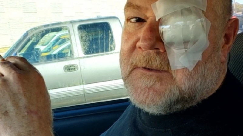 Fundraiser by Carol Bonsall : Support Michael's Urgent Eye Surgery Journey