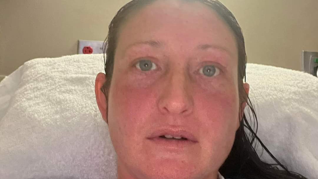 Fundraiser by Cheryl Altman : Donate to Megan Naylor's Healing Fund