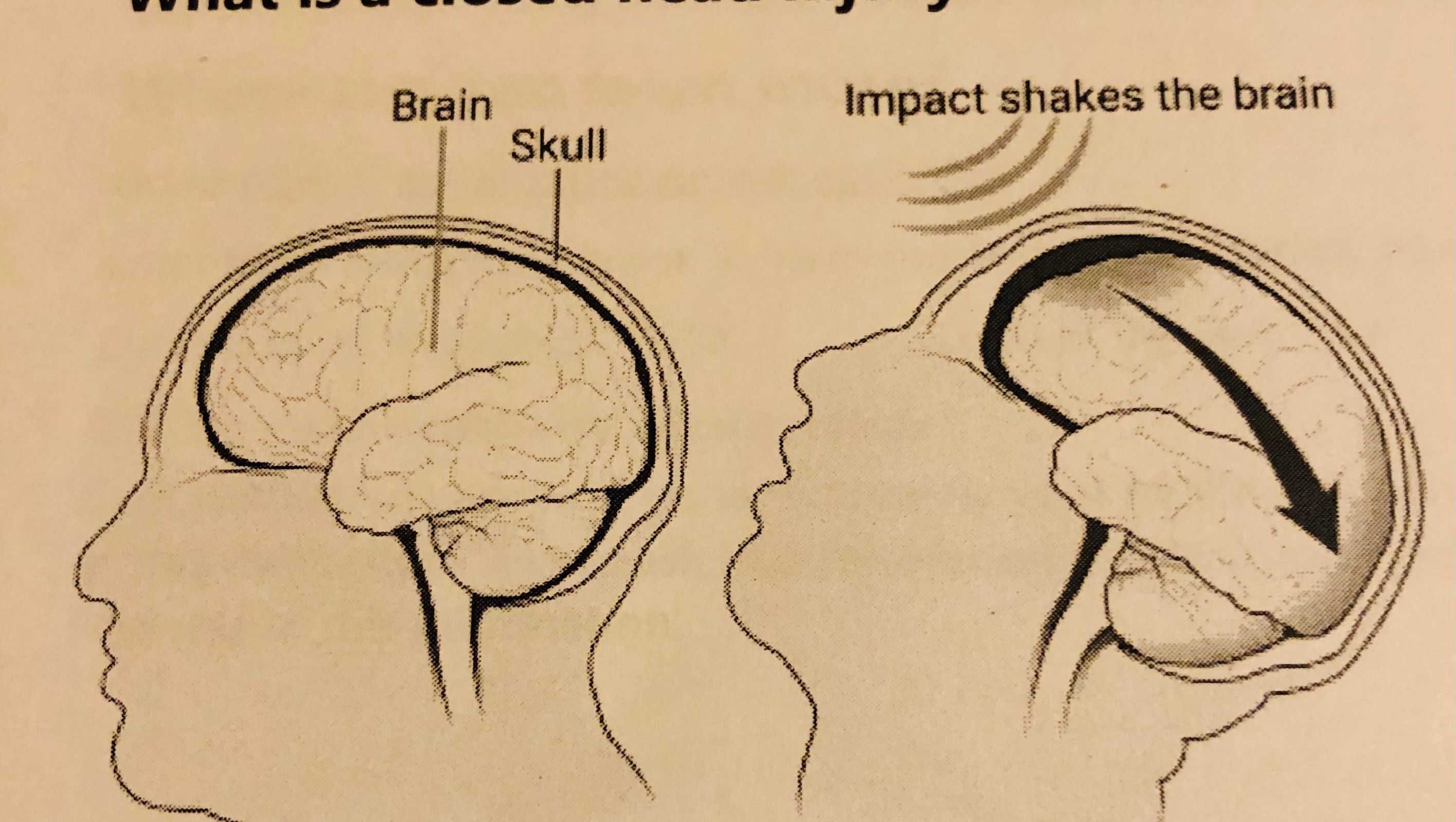 Fundraiser by Amber Lightfoot : Please help Aunty Amber’s “Return to ...