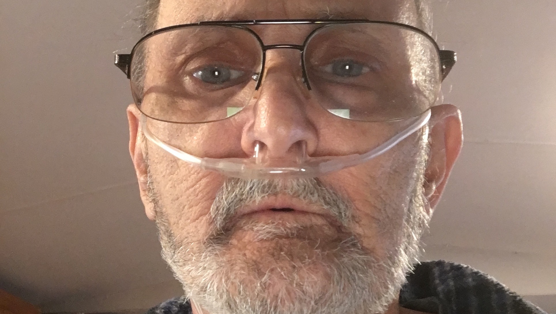 Fundraiser by Robert Covert : Support for lung transplant journey,and ...