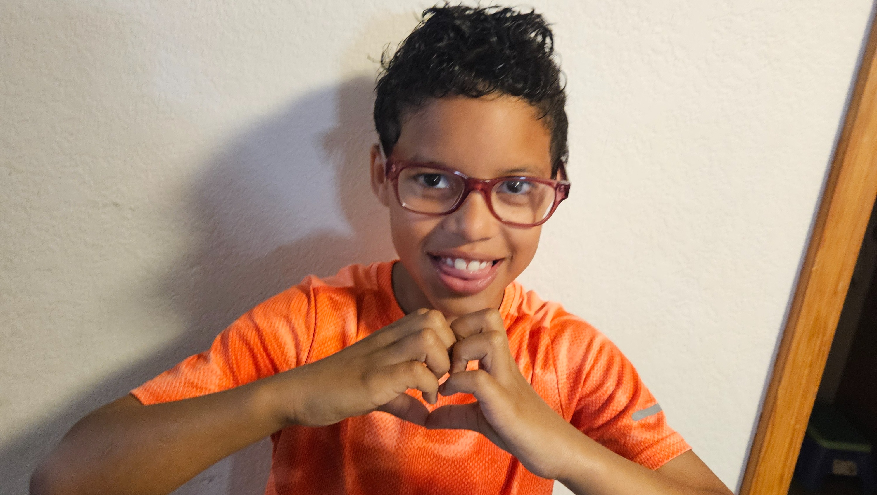 Fundraiser by Tasha Lucas : Help Kieran get intense facial ...