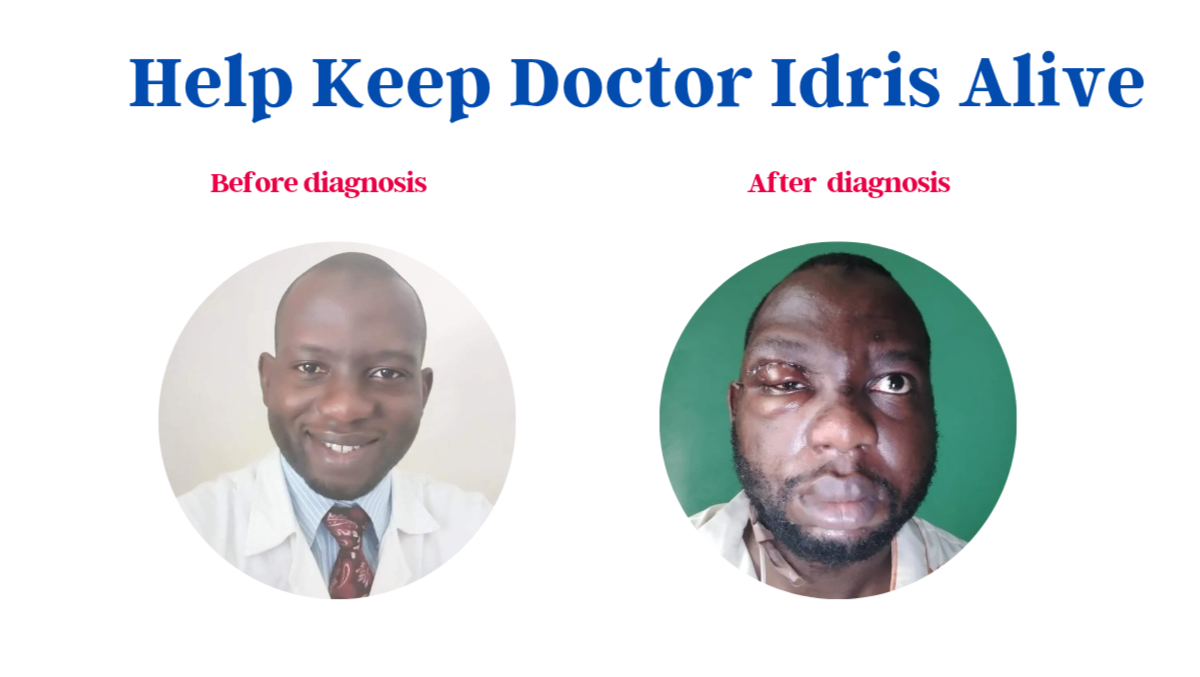 Fundraiser by Baridueh Badon : Help Dr. Idris, an eye doctor beat ...