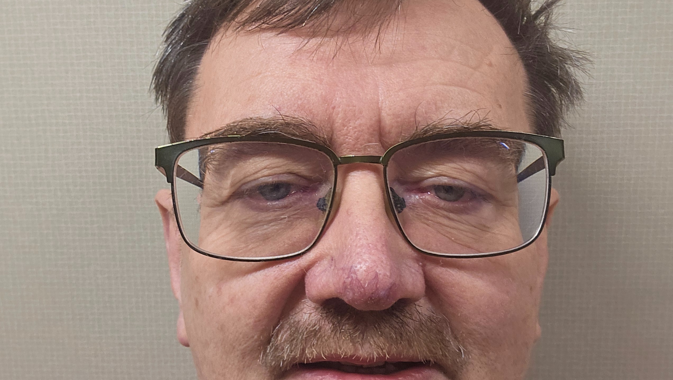 Fundraiser for Bohdan Yeriemienko by Joseph Loftus : TU SVP