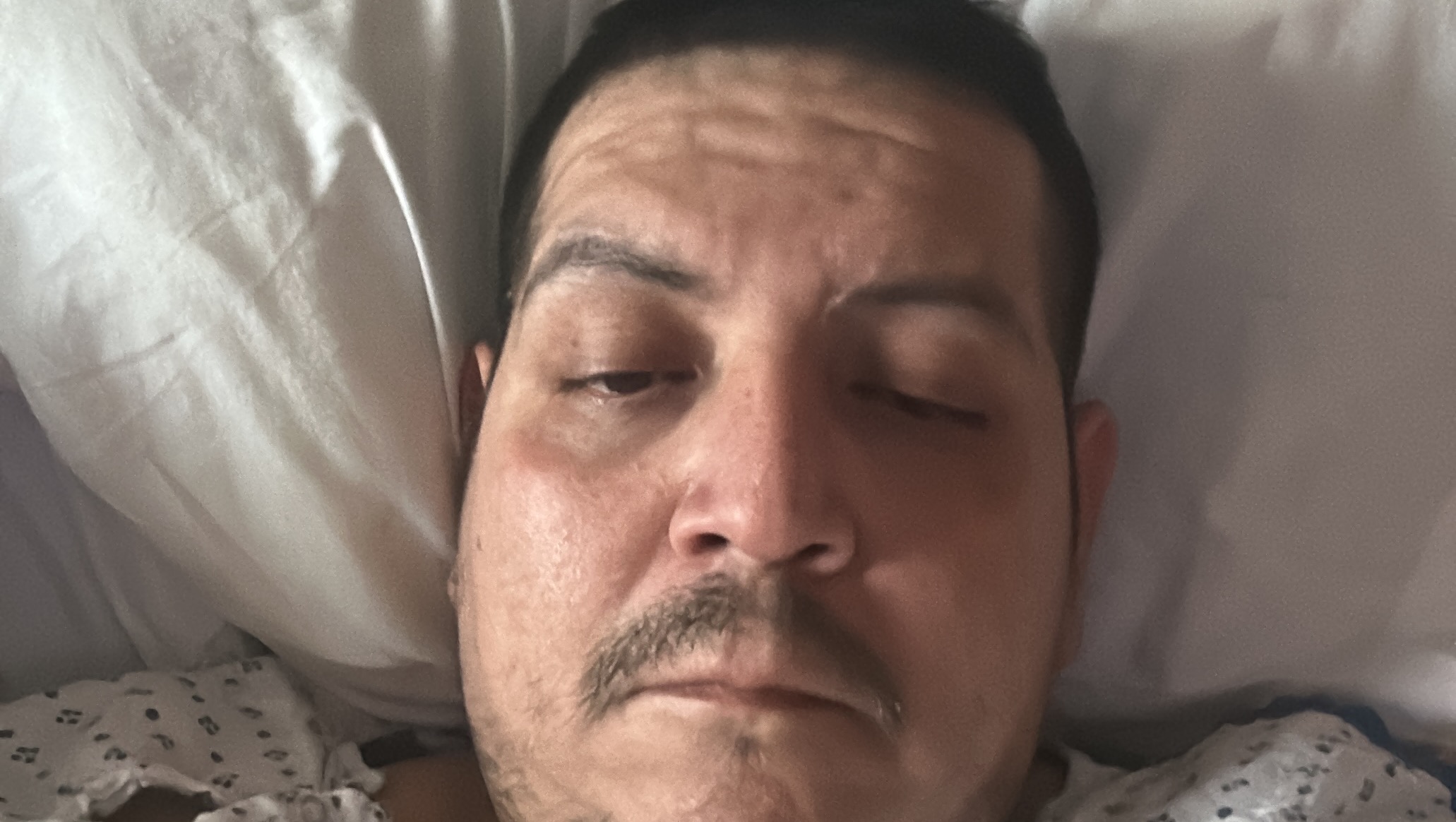 Fundraiser by Augusto Uriona : Support Tito's Recovery from Severe Gangrene