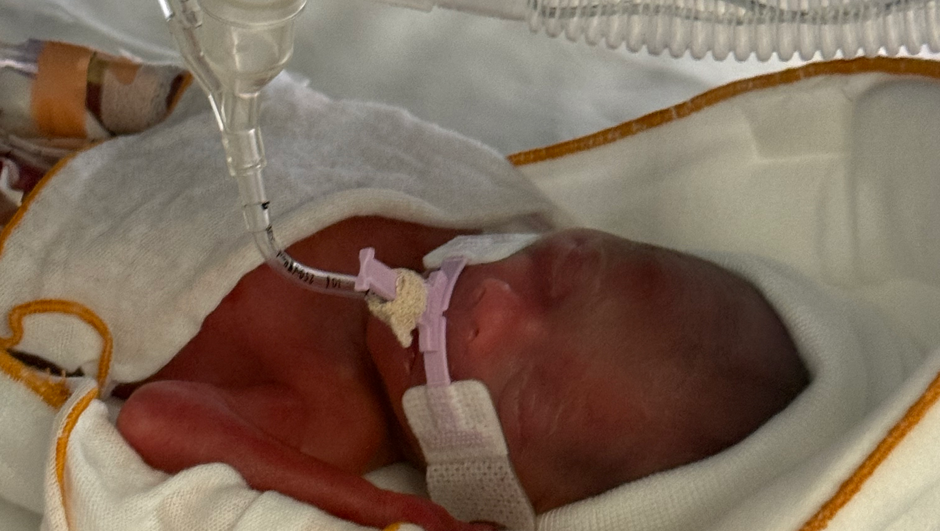 Fundraiser for Blake James by Megan James : Remembering baby Harrison