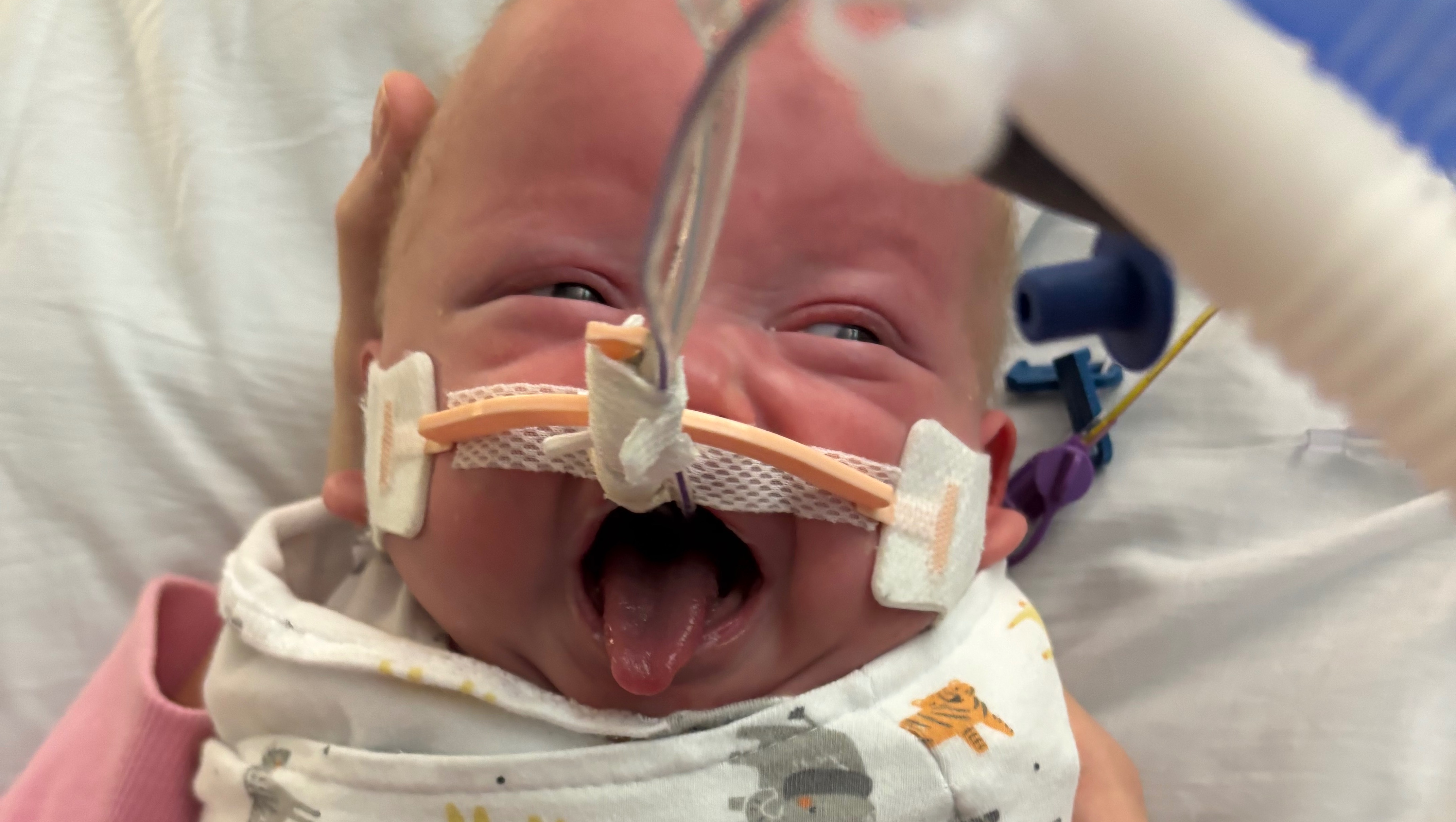 Fundraiser by Kailey Wilson : Help Cooper Breathe Easy one day