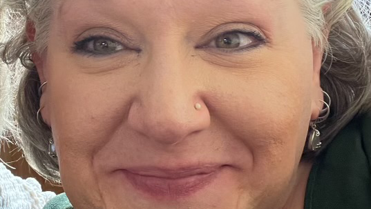 Fundraiser for Jennifer Early by Elise Ostrander : Support Jen's Eye ...