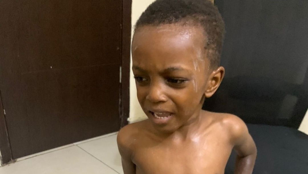 Fundraiser by Rhoda Obayuwana : Help Ryan Overcome Mitral Valve Defect