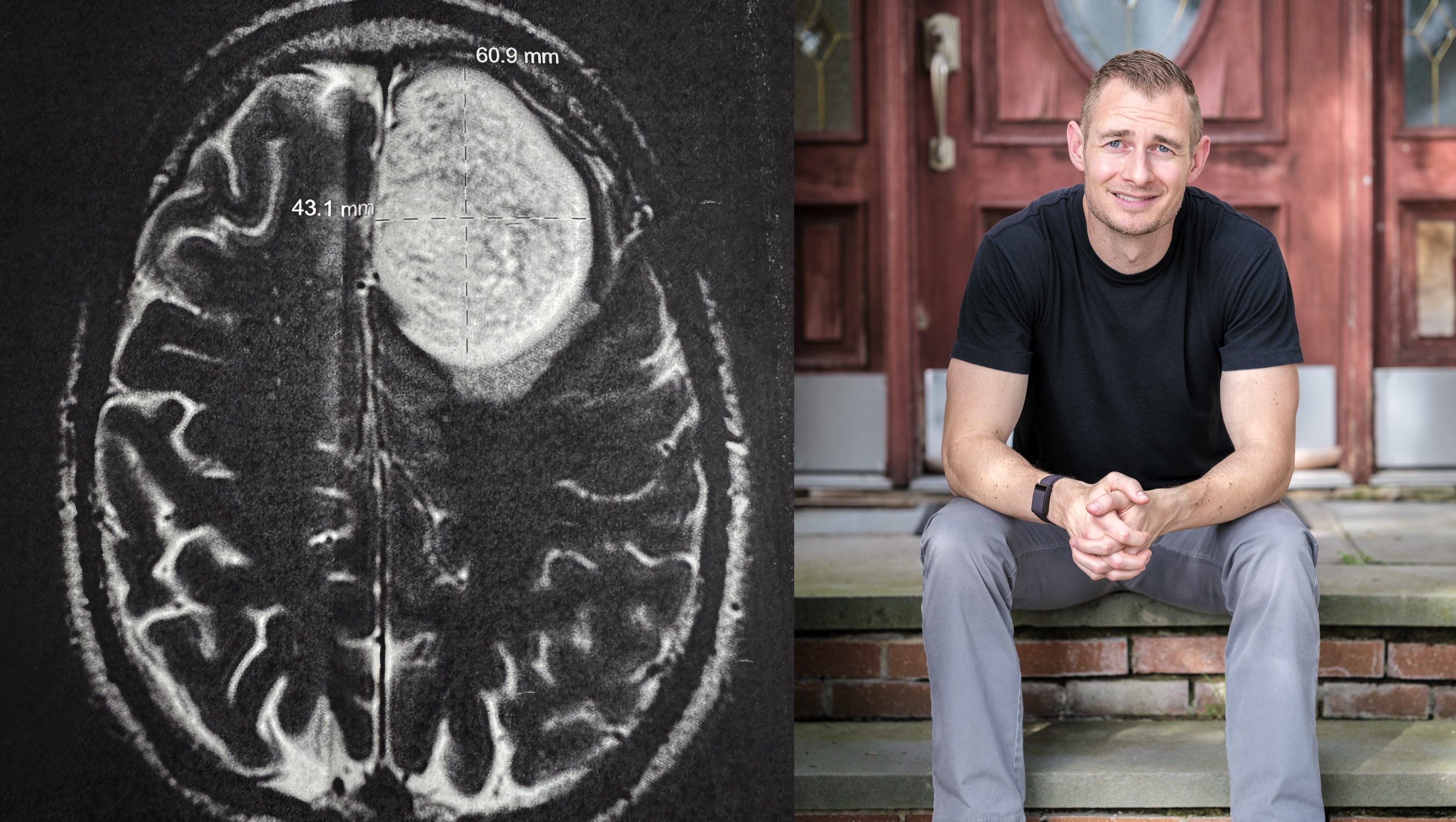 Fundraiser by Michael Layton : Support Brain Surgery Recovery for ...