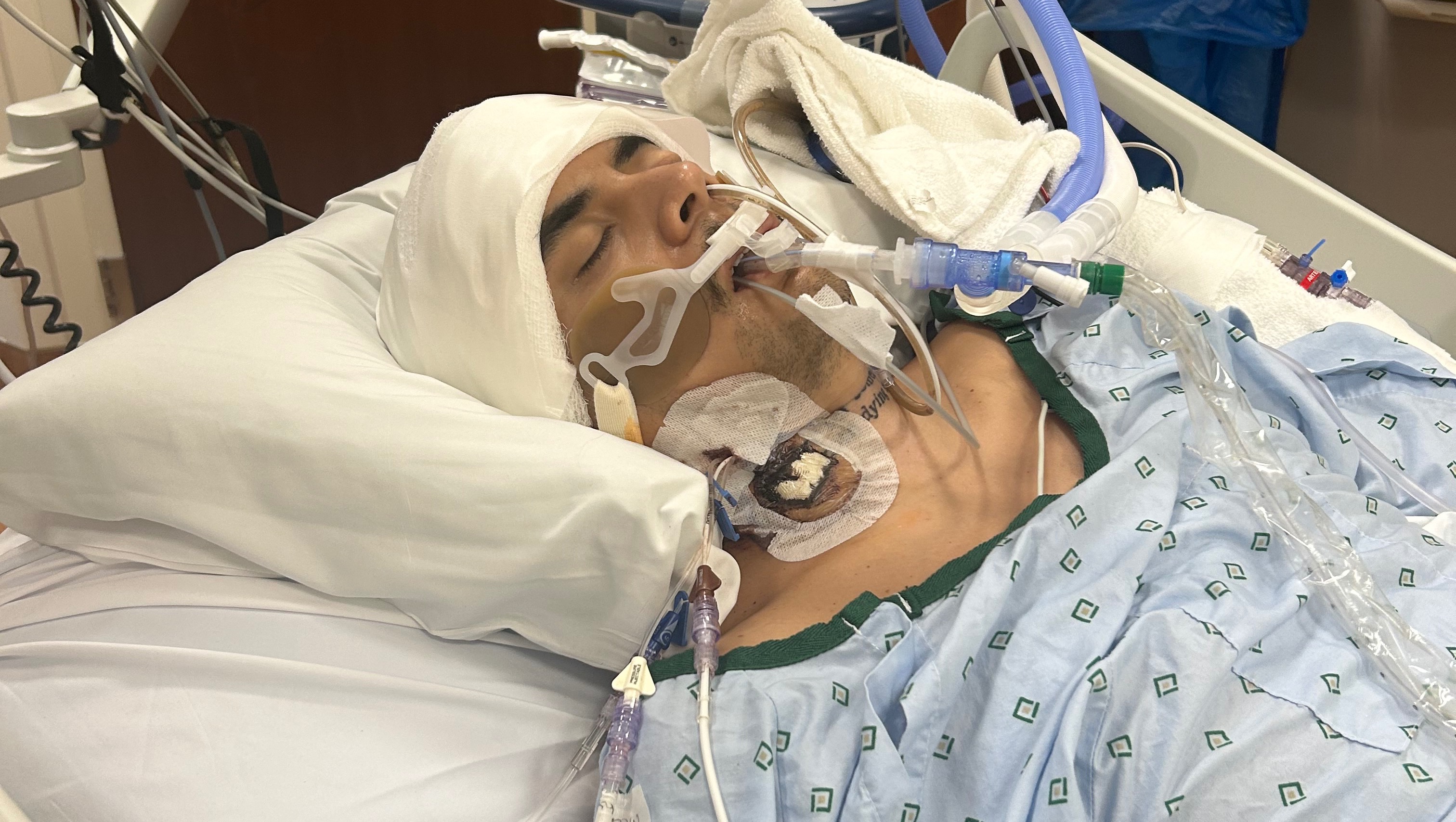Fundraiser for Olga Fuentes by Sandra Blandino : Support Alain's ...