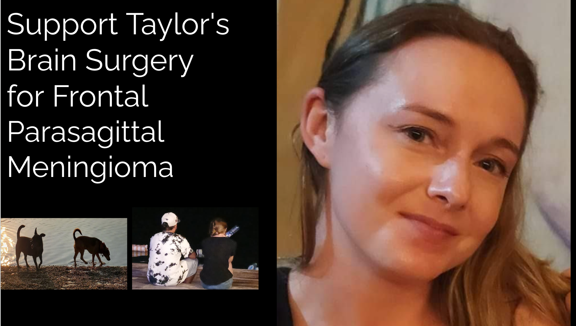 Fundraiser by Taylor Stuart : Support Taylor's Surgery for Frontal ...