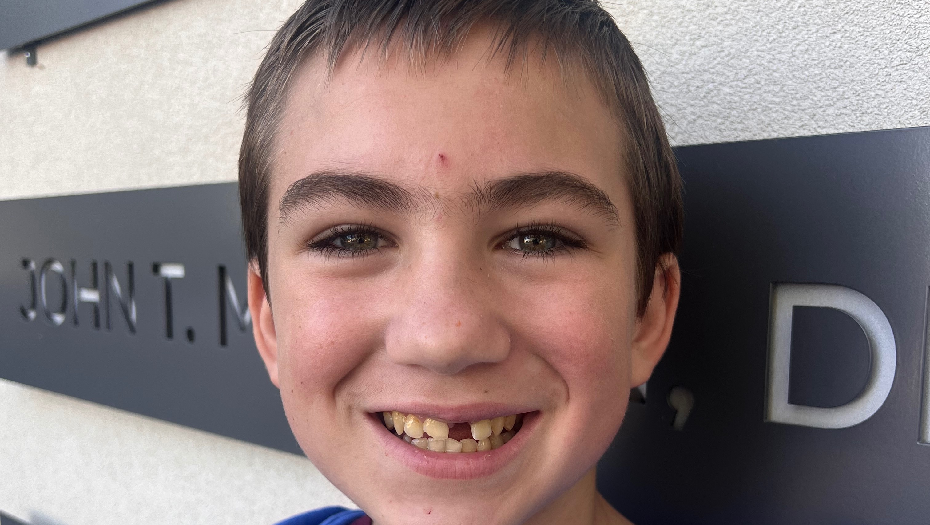 Fundraiser by Laura Floyd : Restore Brantley's Smile: Donate for His ...