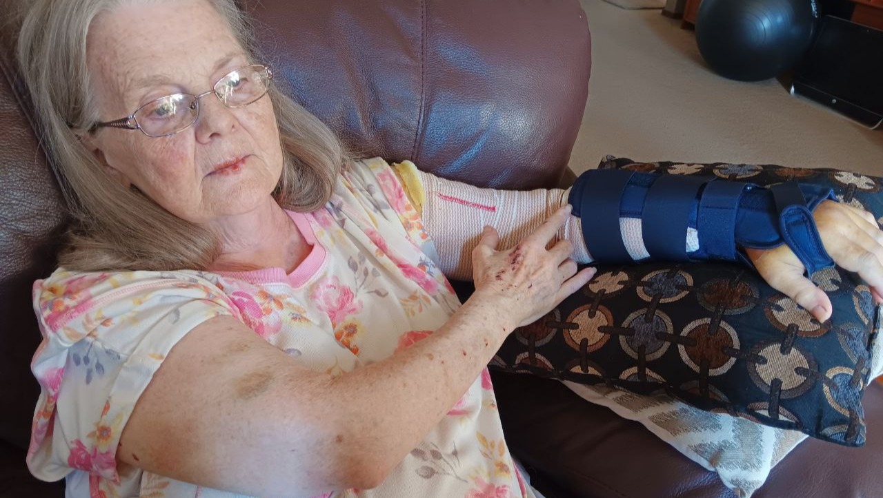 Fundraiser by Megan Durbin : Help Becky Heal After Dog Attack