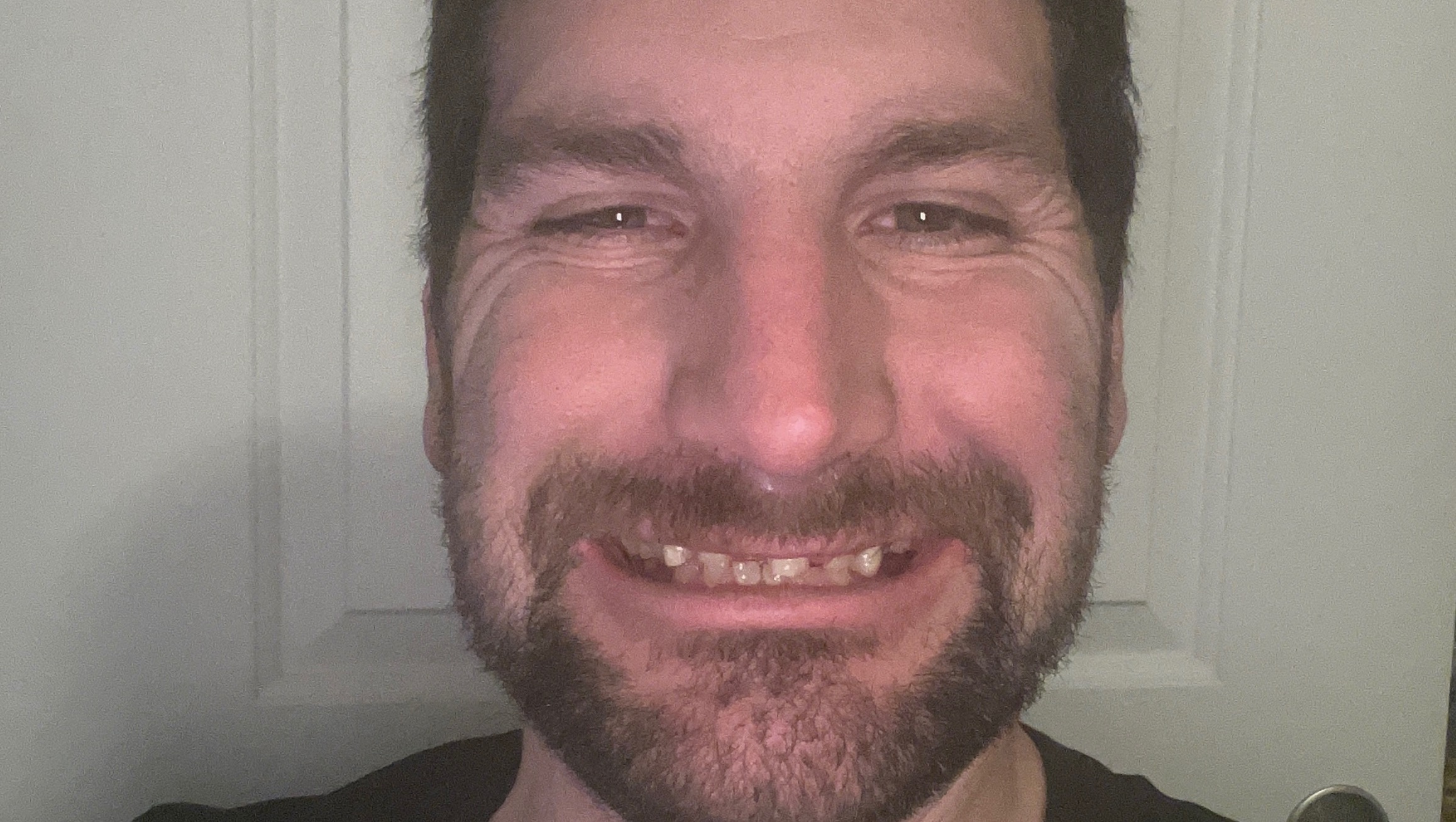 Fundraiser by Rick Dean : Support for Beautiful New Teeth