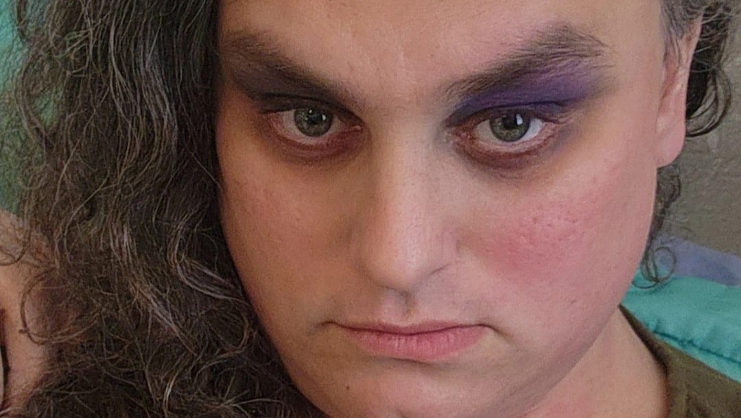 Fundraiser by Sally Jane Black : Help a Trans Woman Get Back Surgery