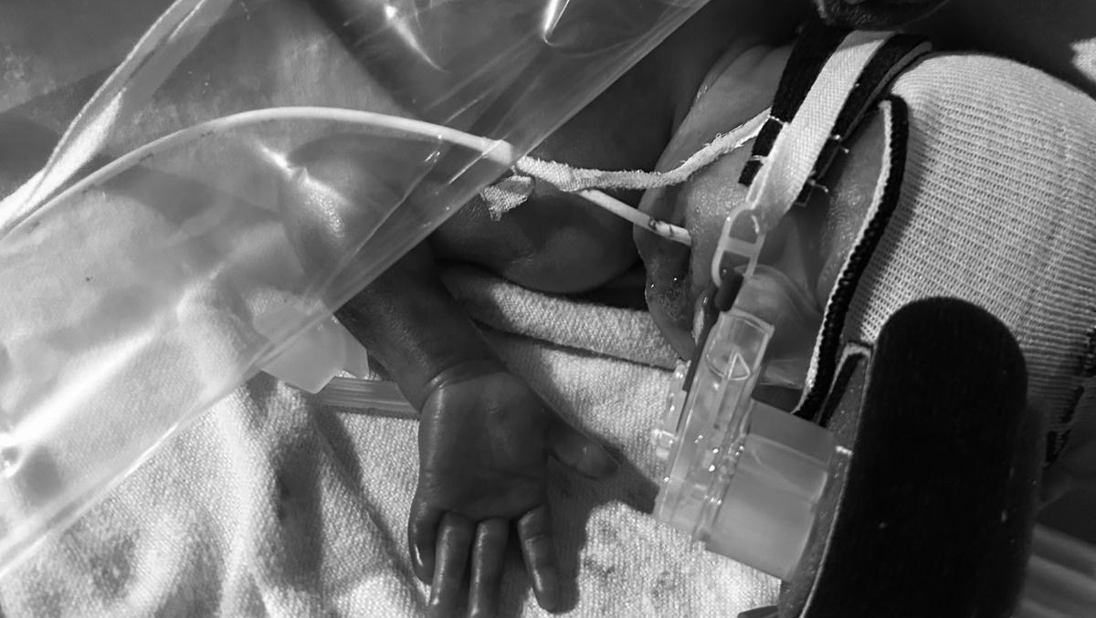 Fundraiser by Chelsea Mcintyre : NICU in Royal Victoria Hospital