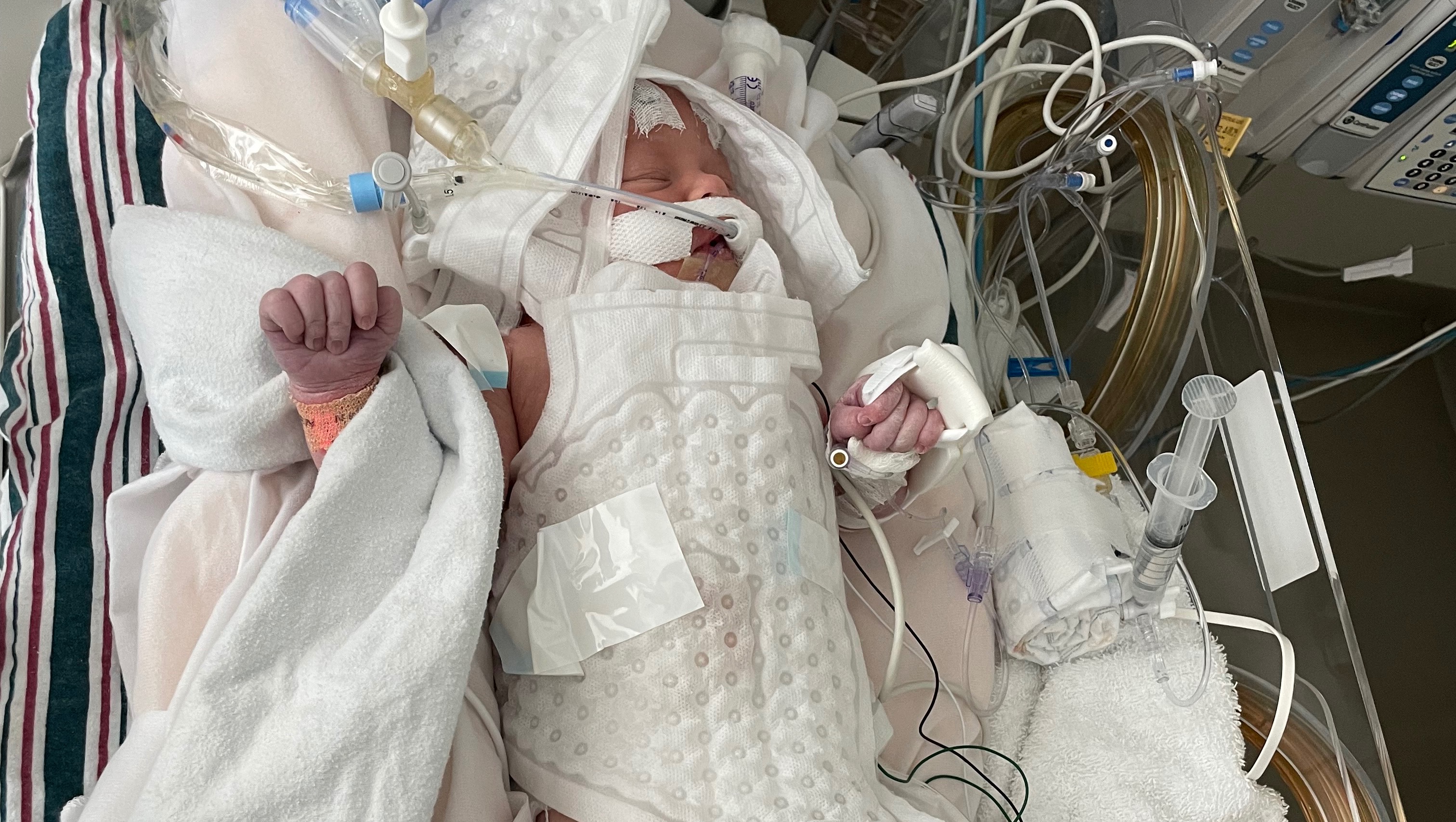 Fundraiser for Anthony Knapstein by holly kriston : Support Chelsey and ...