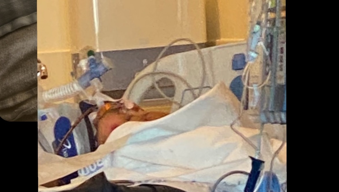 Fundraiser for Emi Cruz by Axel Hernandez : Help Emi Cruz Recover from ...