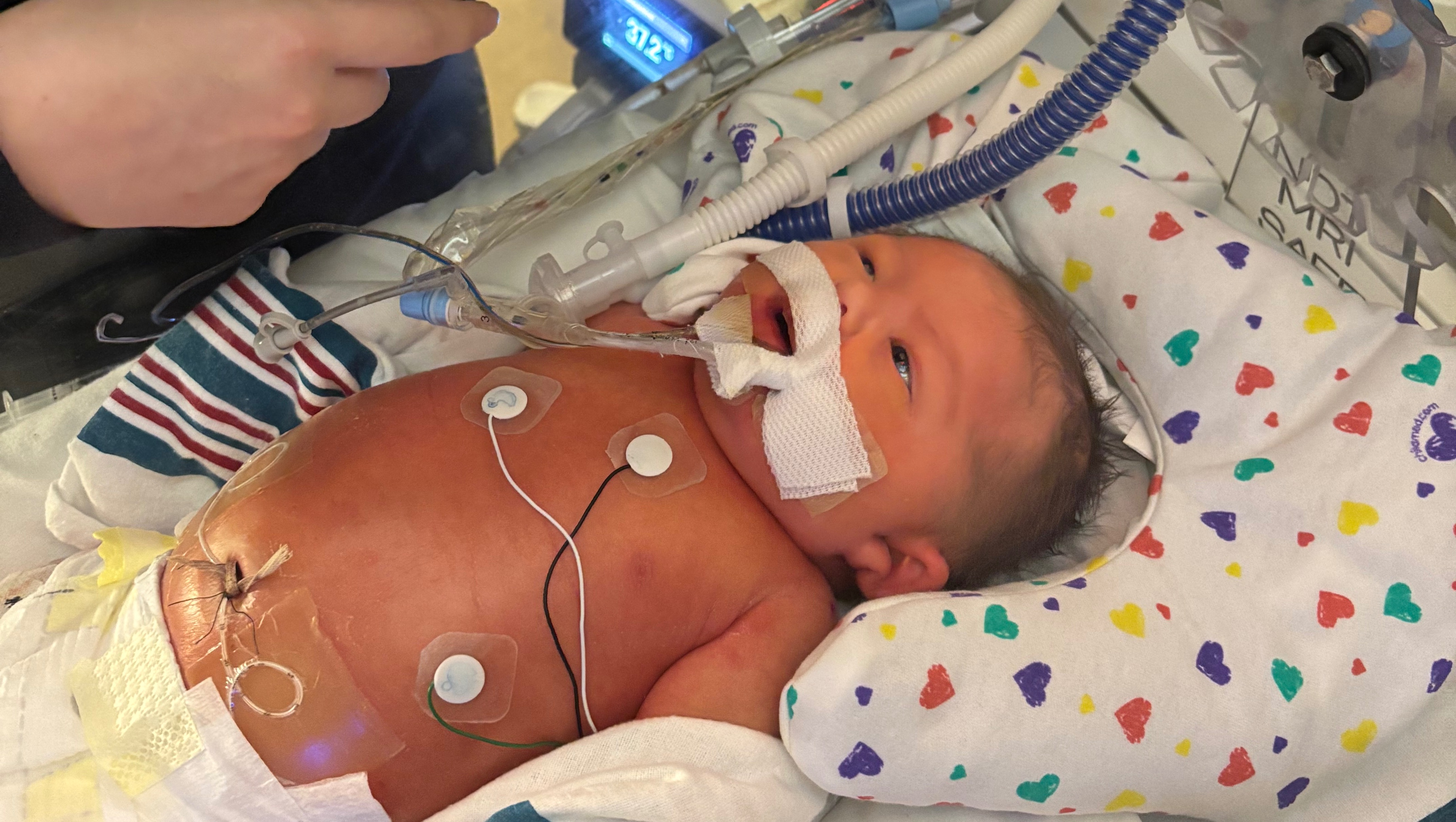 Fundraiser for Halie Webb by Stacy Ober : Support Oaklynn's Fight for a ...