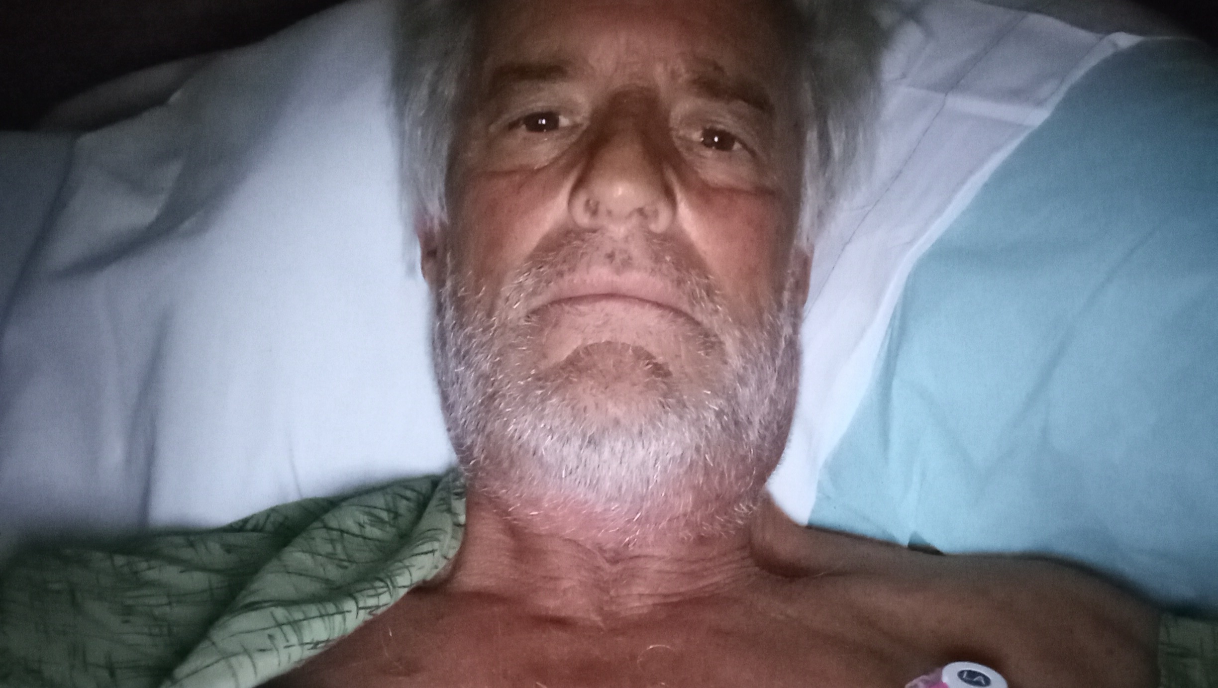 Fundraiser by William T Higgins : Support Bill's Recovery from Heart ...