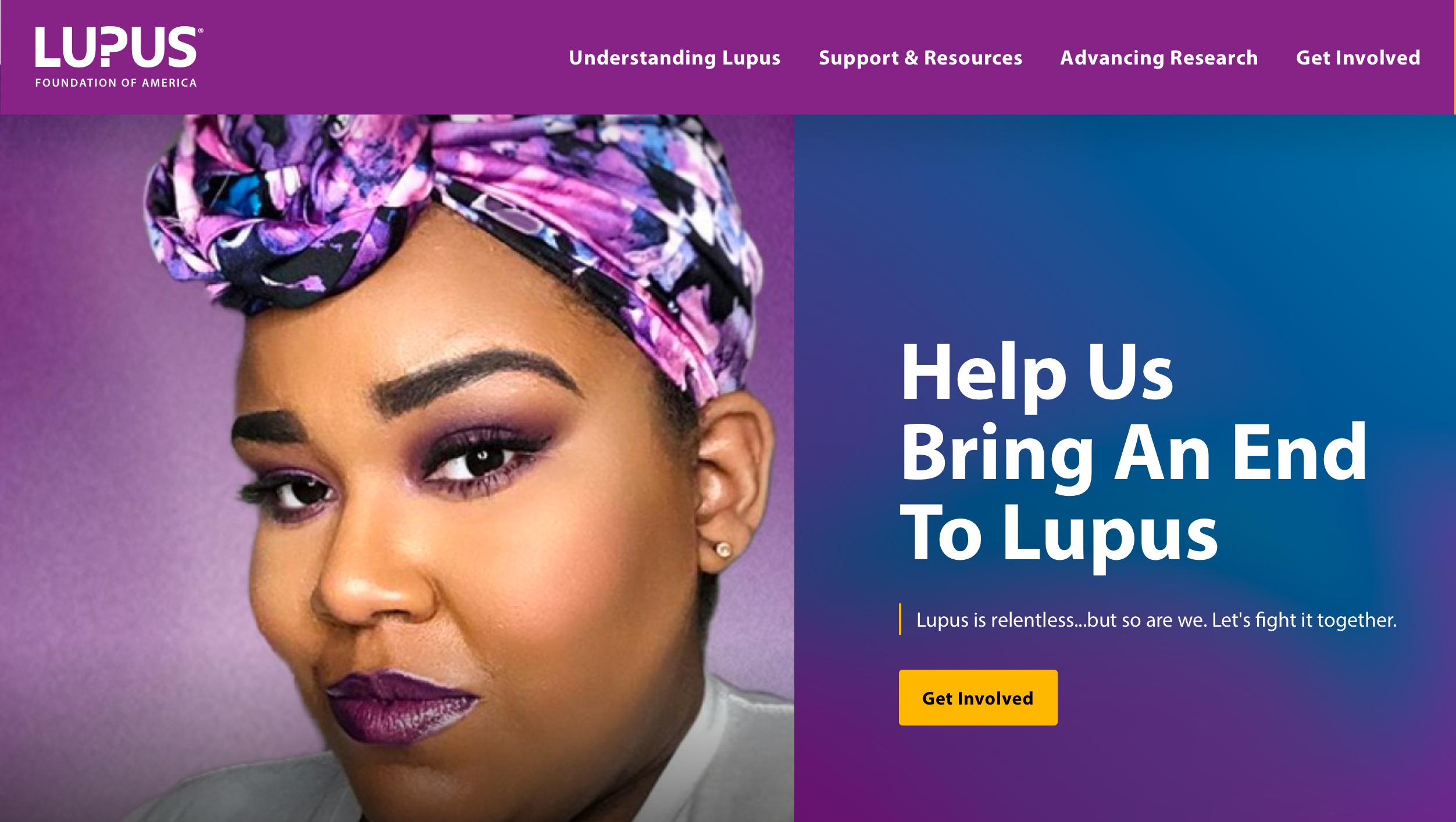 Fundraiser by Caroline Jamison : Support Caroline's Fight Against Lupus