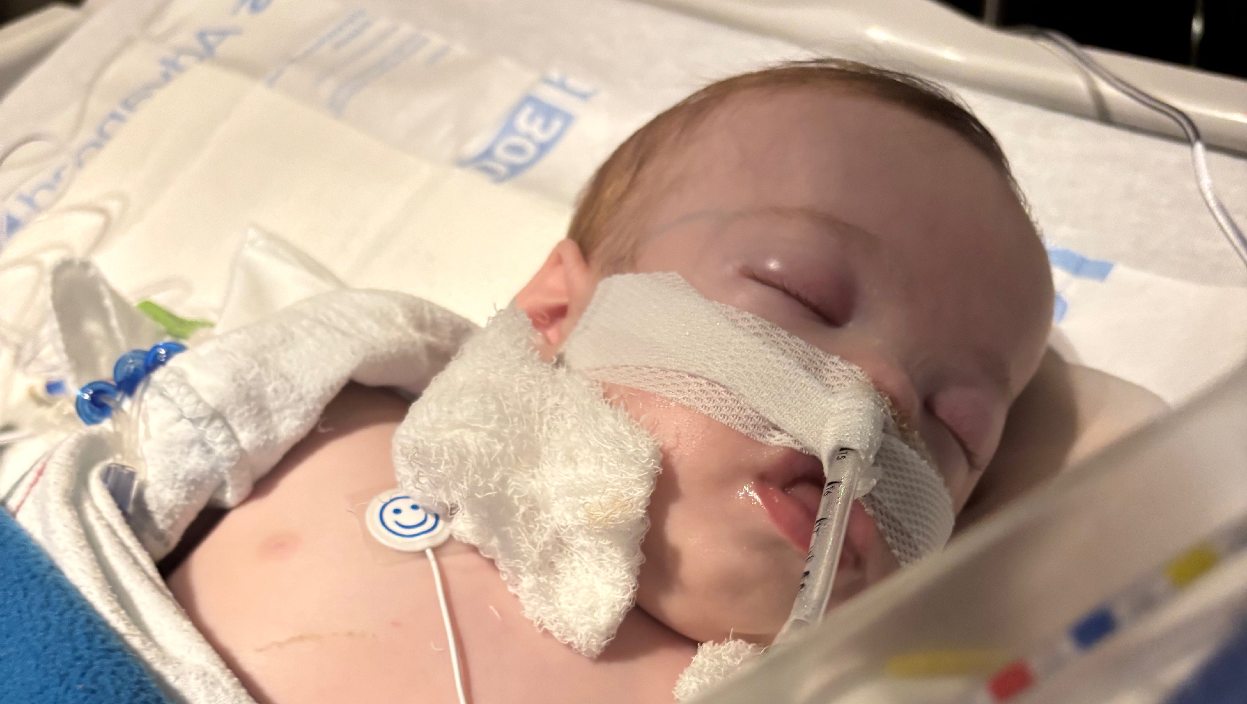 Fundraiser by Caliyah Walker : Surgery and medical funds for Grayson