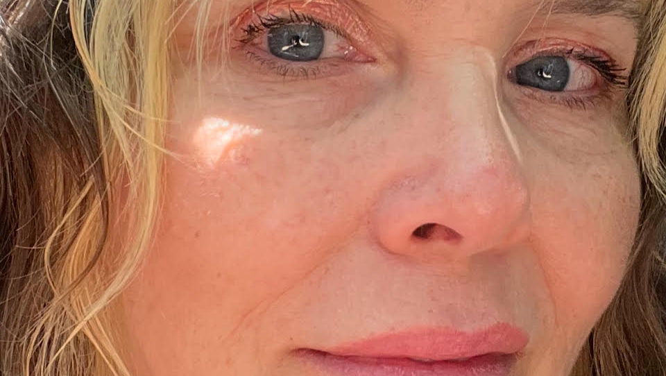 Fundraiser by Myfanwy Ashmore : Help Myfanwy Recover from ALIF 360 ...