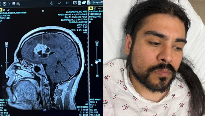 Fundraiser by Elissa Sanchez : Support Roberts Fight Against Glioma ...