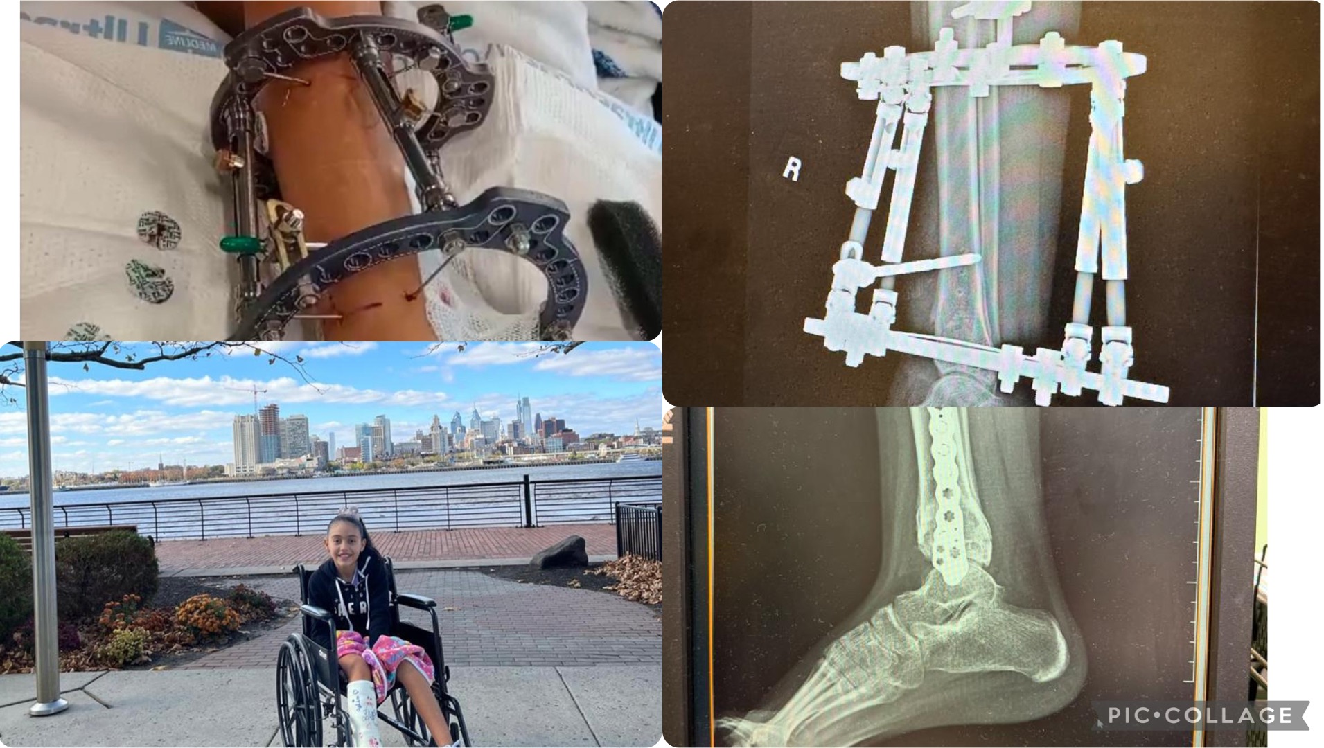 Fundraiser by Sandra Naranjo : Support Sara Sofia's Recovery and Healing