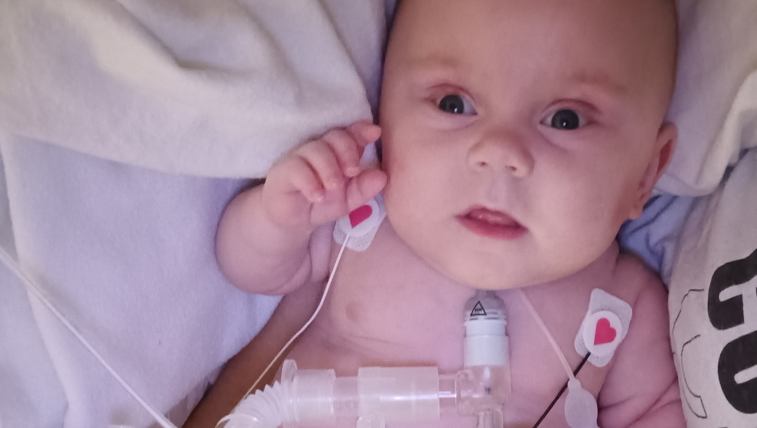 Fundraiser by Cassandra Edwards : Help Our Baby Girl Breathe at Home