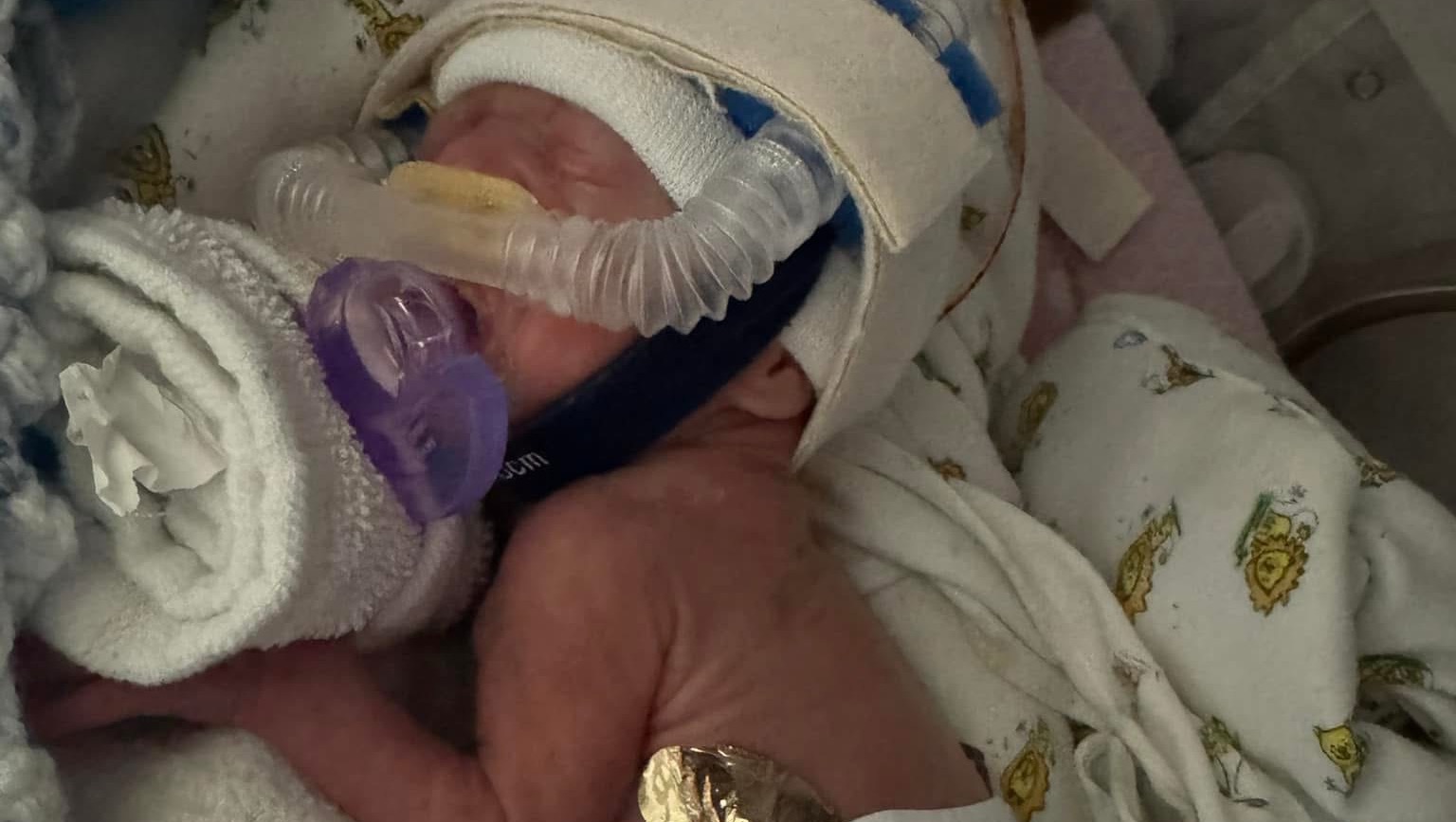 Fundraiser for Tyler Rice by Rose Knadler : Please help little Logan ...