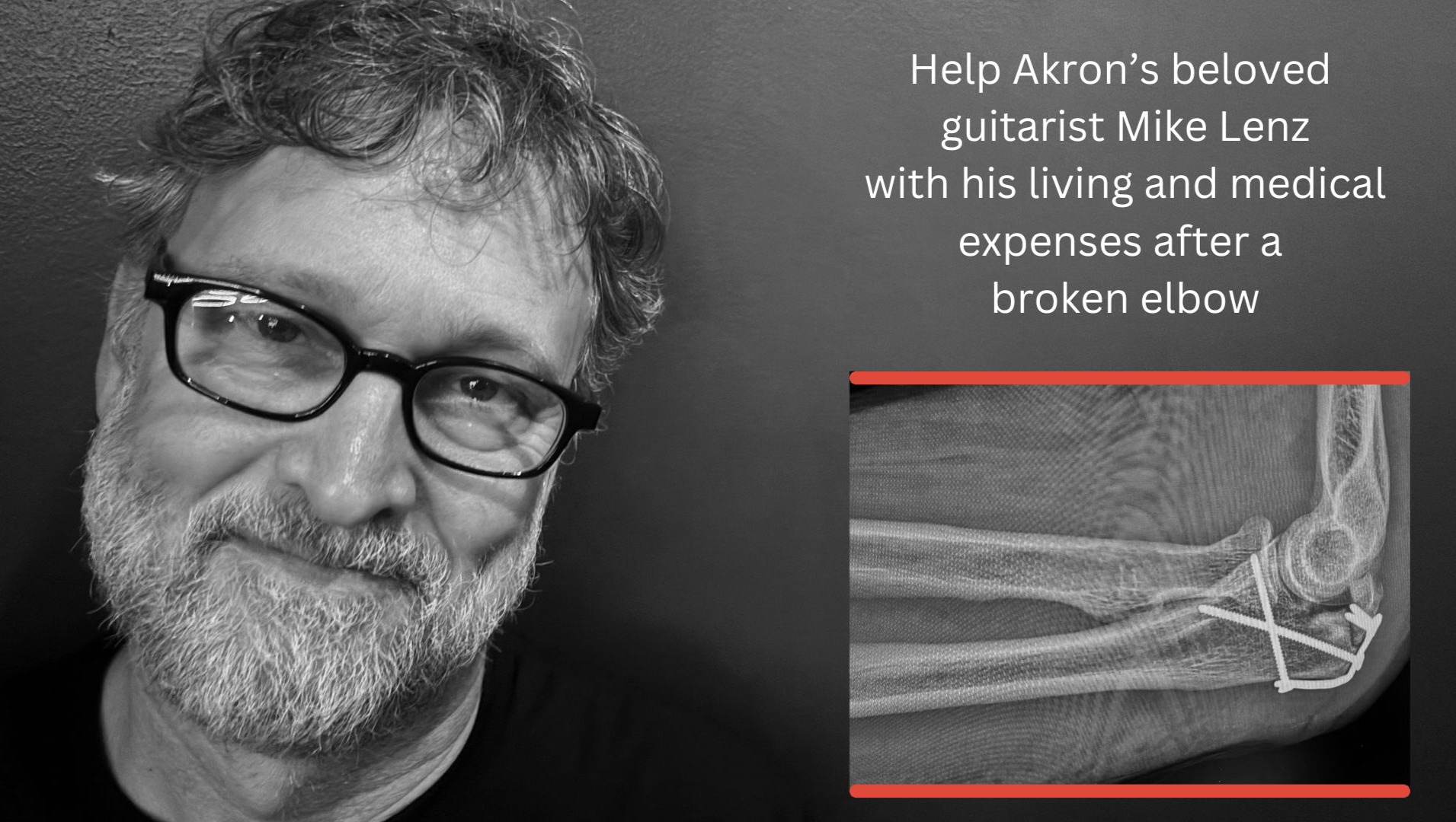 Fundraiser for Michael Lenz by Jennifer Maurer : Help Mike Lenz Recover ...