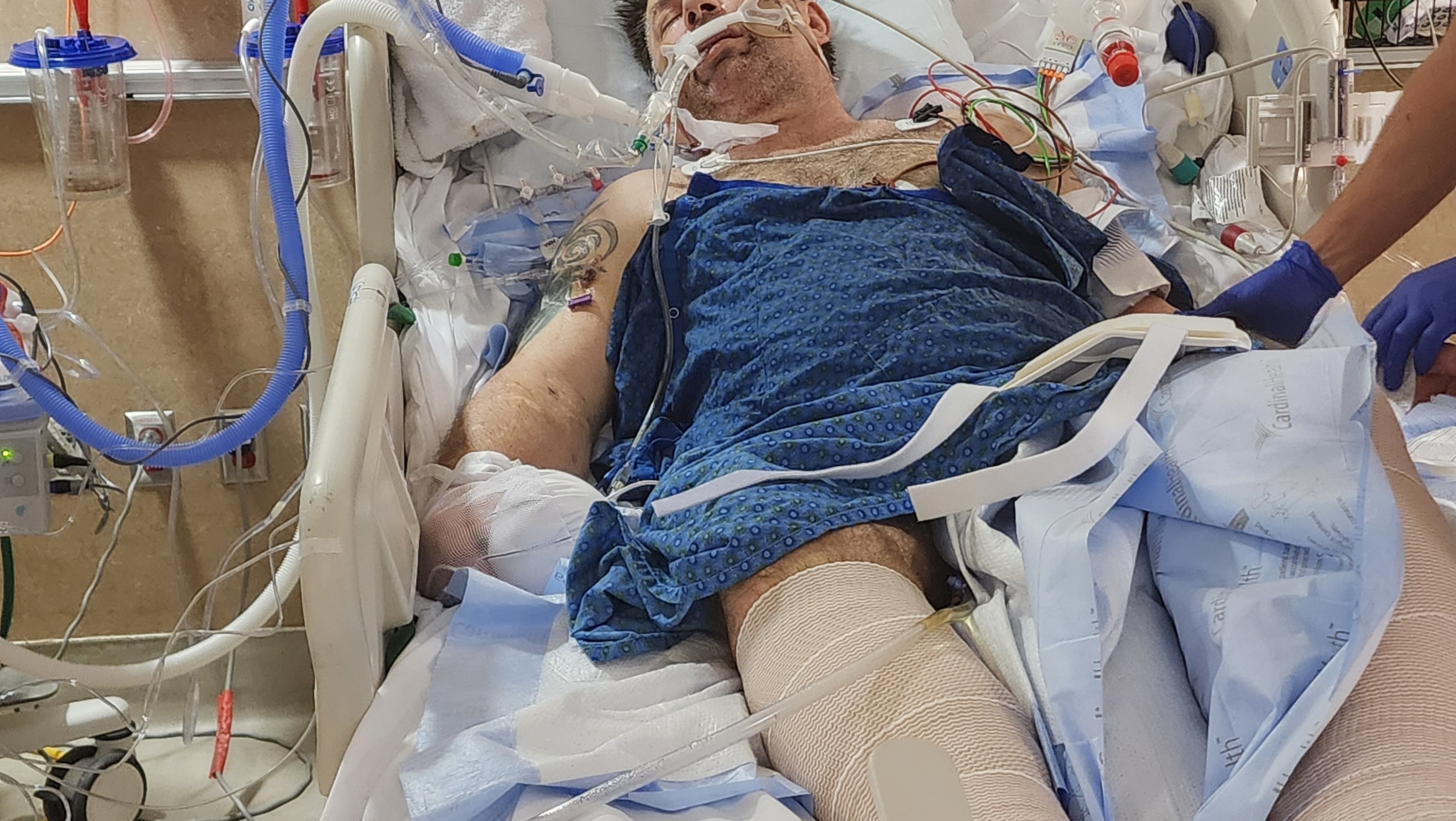 Fundraiser by Chad McKenzie : Support Brian's Long Road to Recovery