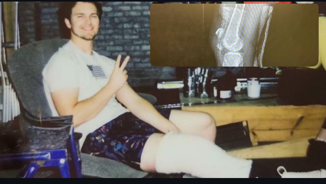 Fundraiser for Jacob Case by Jake Lownsdale : Support Jacob's Recovery ...