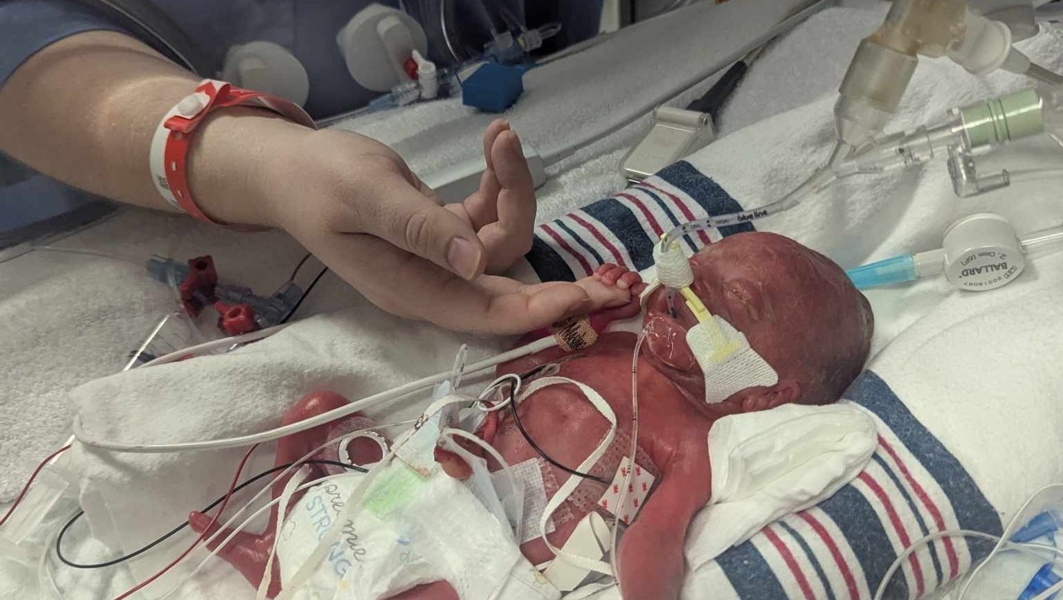 Fundraiser for Nate Elliott by Rachel Pessah : Baby Benjamin