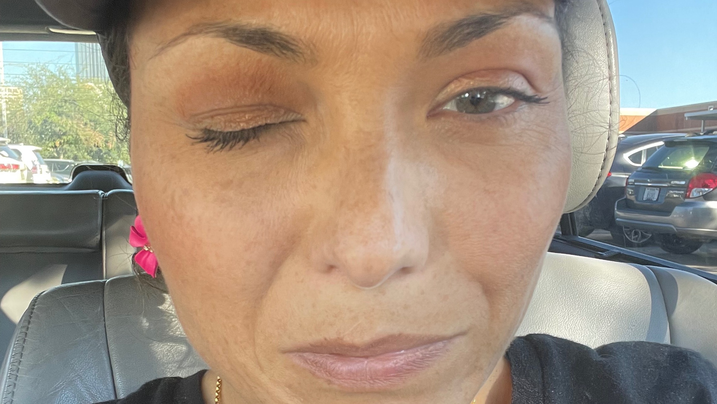 Fundraiser by Fiona Naidoo : Donate for Essential Surgery to Regain Vision