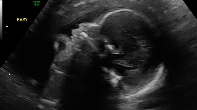 Fundraiser by Amy Stultz : Support Ashley's Journey to 34 Weeks