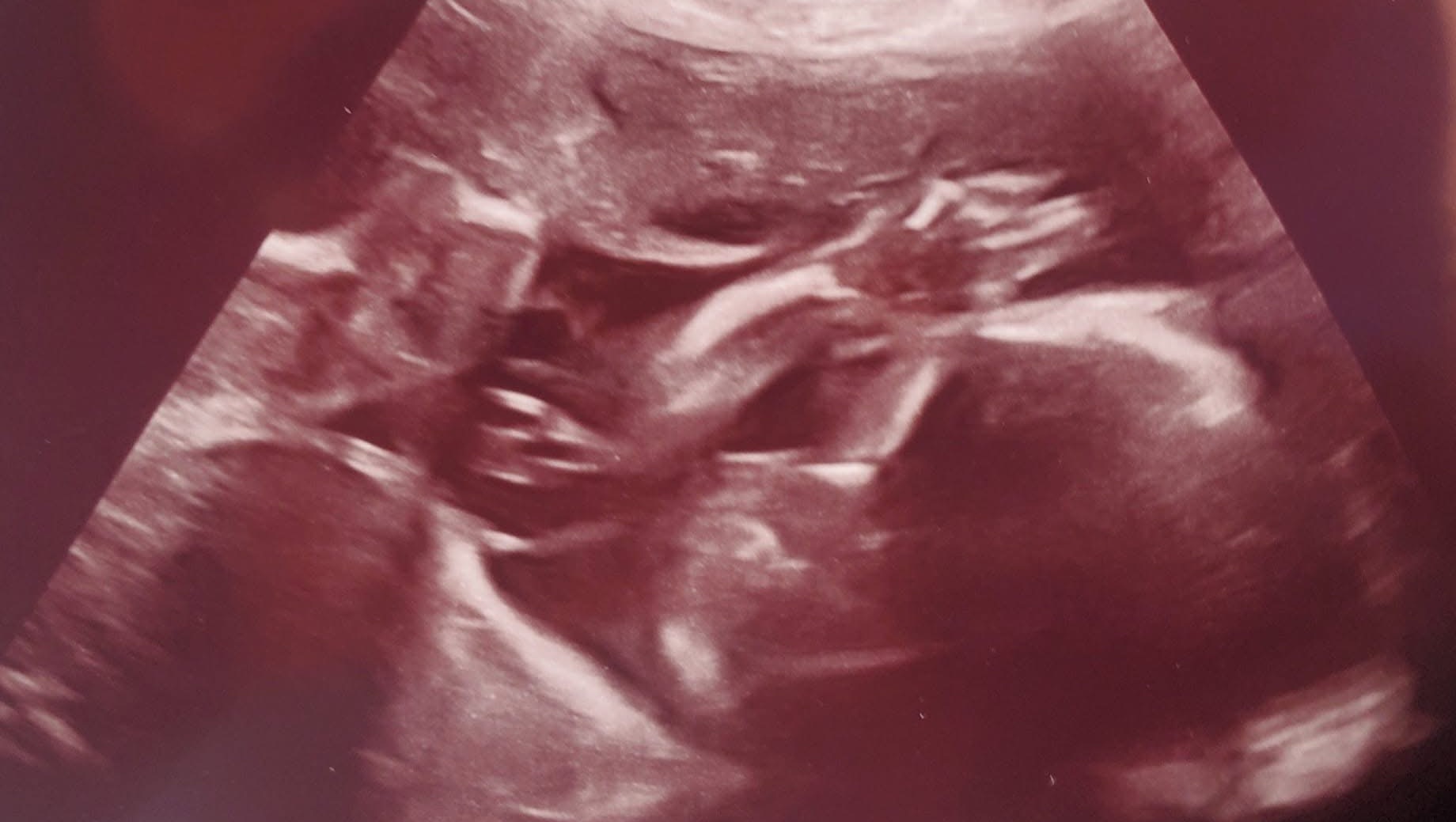 Fundraiser by Erika Martineau : Help Cindy Welcome Baby Blakely