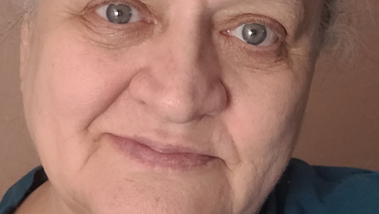 Fundraiser by debra ryan : Widow Needs Pacemaker to Save Her Life