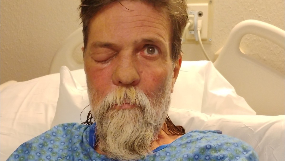 Fundraiser for Carolyne Perdue by Lyn Rosas : PLEASE HELP OUR LINEMAN ...