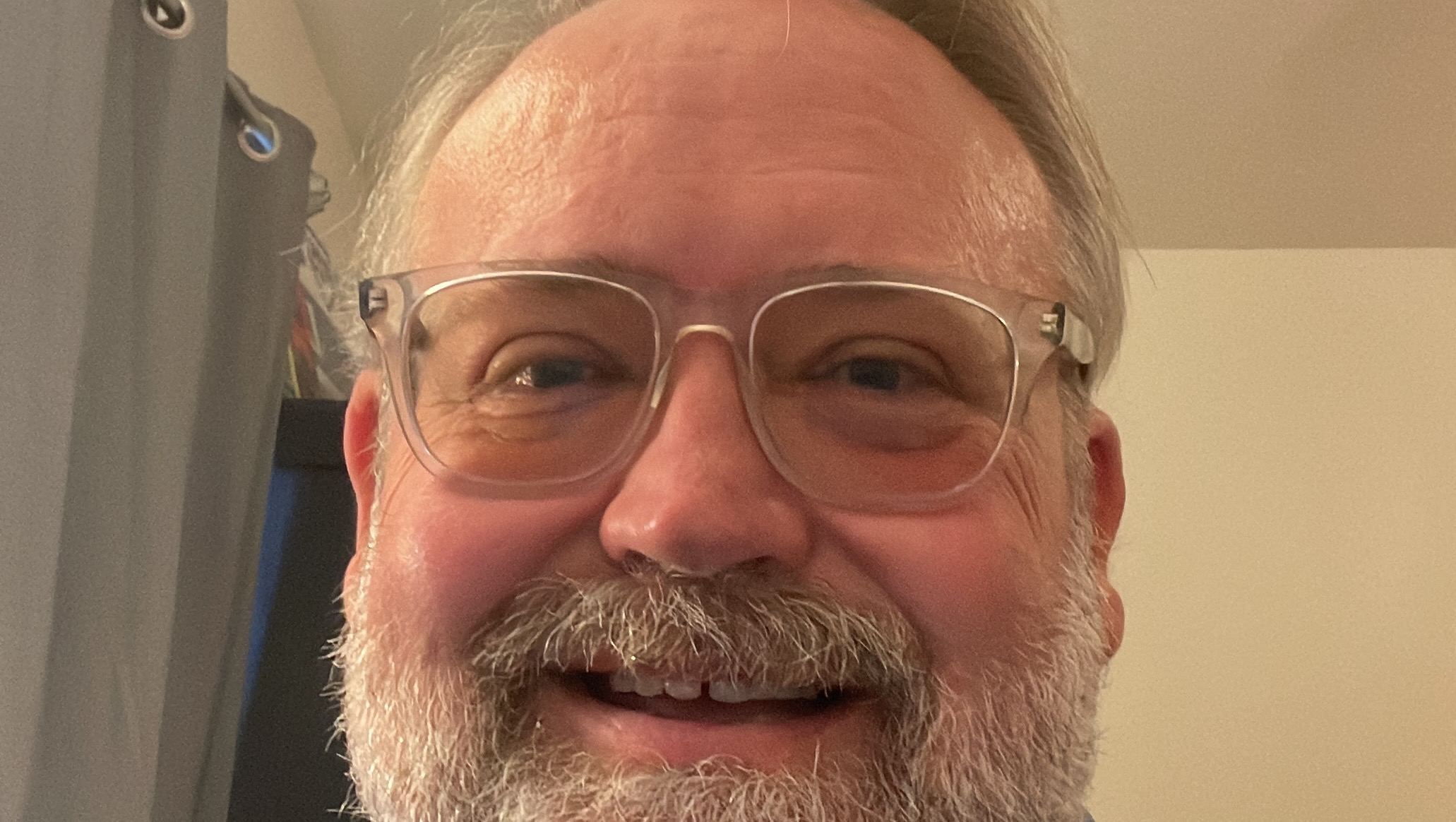 Fundraiser by Dave Hawk : Support My Hip Replacement Journey