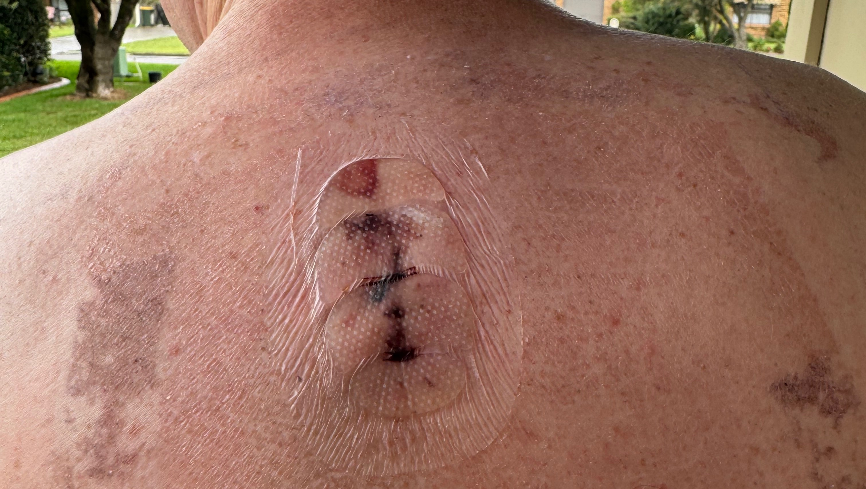 Fundraiser for Steve Reynolds by Sam G : Help Steve and his family ...